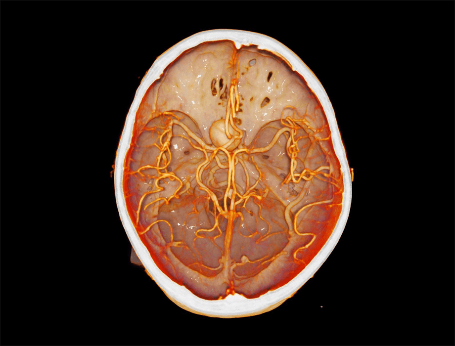 United Neuro (uWS, uReal, uSmart) | United-Imaging Korea Healthcare