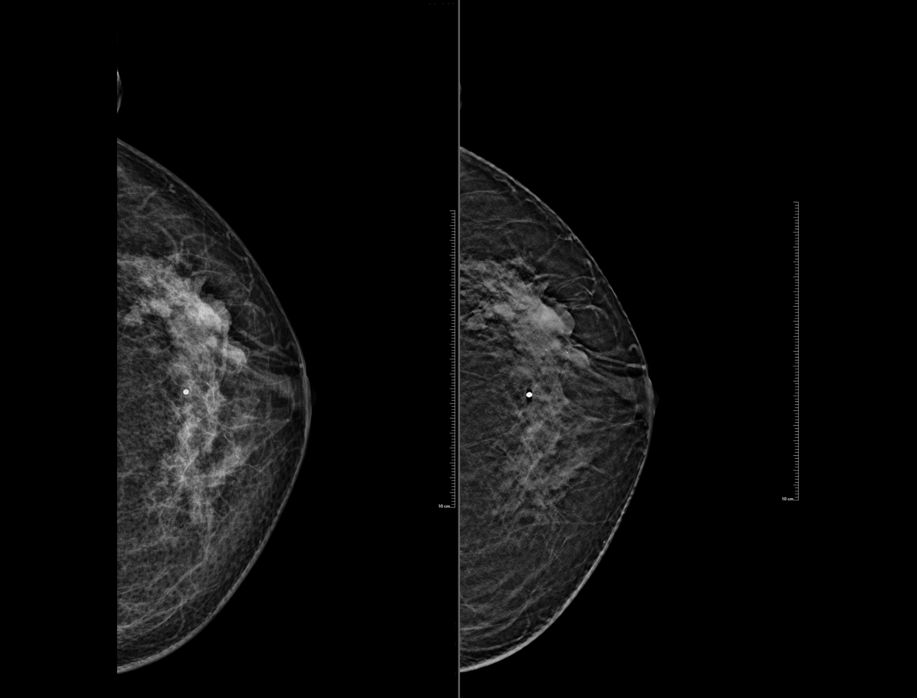 United Neuro (uWS, uReal, uSmart) | United-Imaging Korea Healthcare