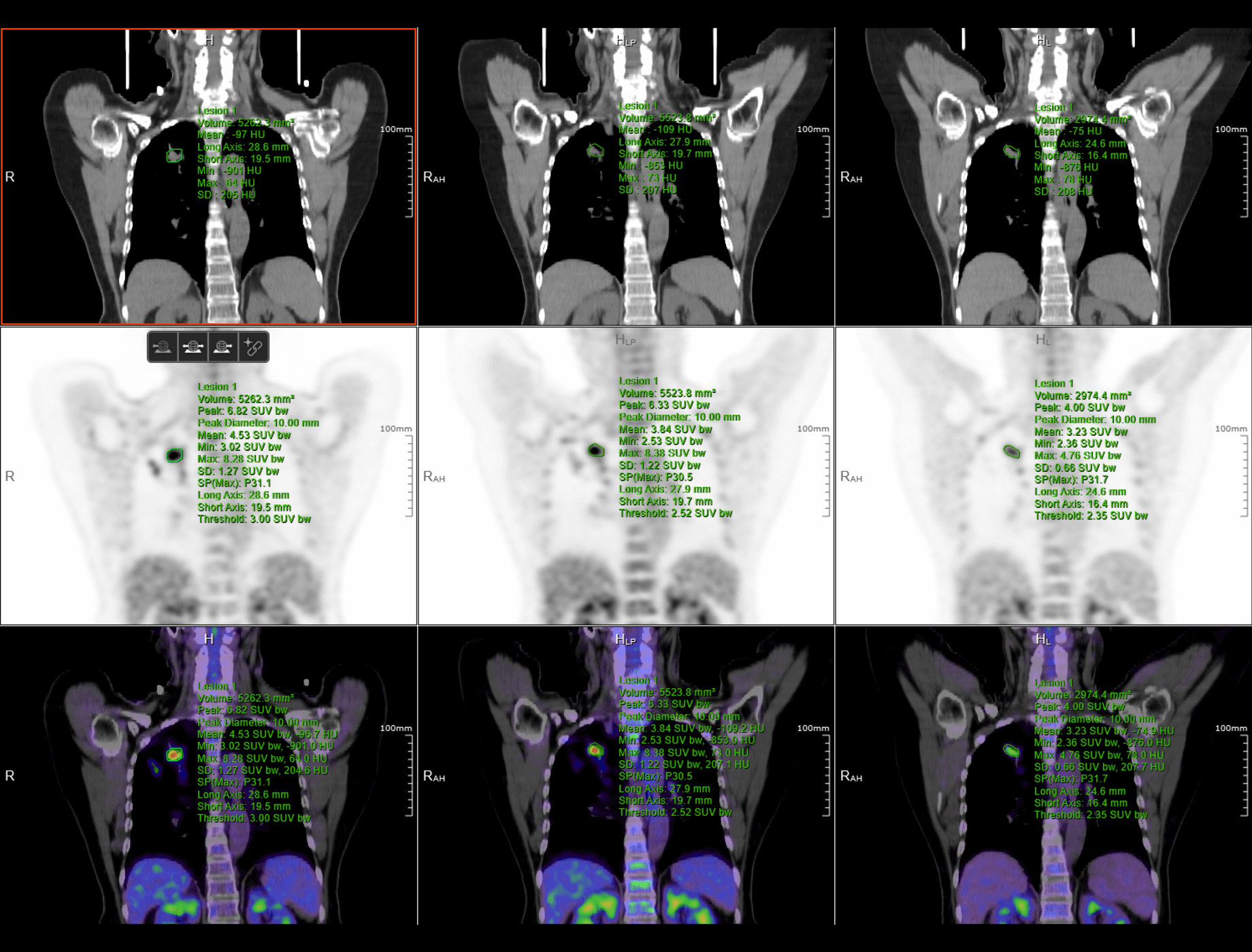 United Neuro (uWS, uReal, uSmart) | United-Imaging Korea Healthcare