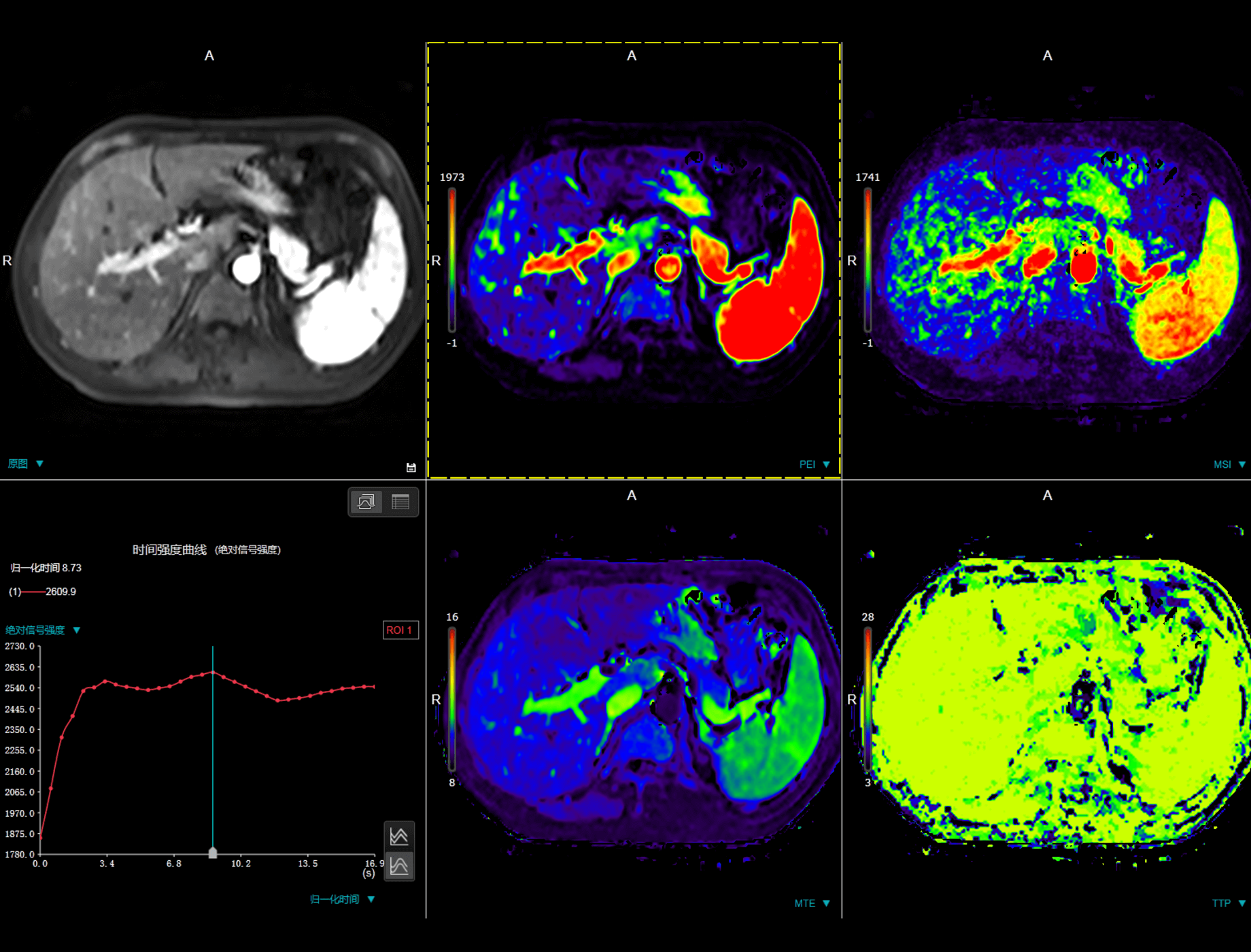 United Neuro (uWS, uReal, uSmart) | United-Imaging Korea Healthcare