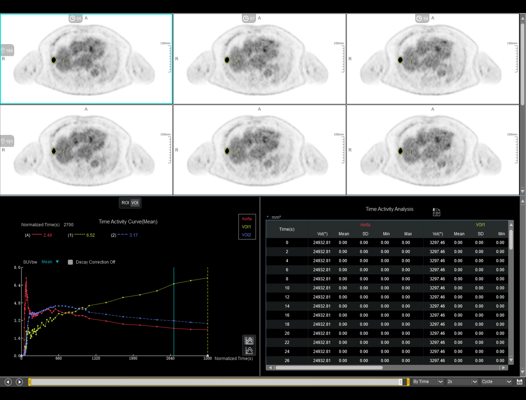 United Neuro (uWS, uReal, uSmart) | United-Imaging Korea Healthcare