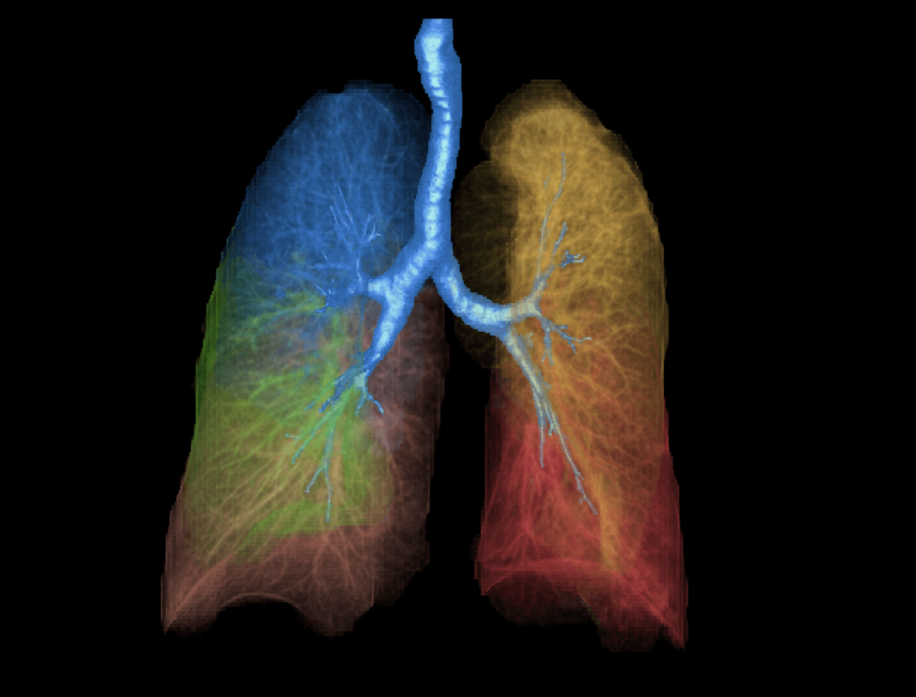 United Neuro (uWS, uReal, uSmart) | United-Imaging Korea Healthcare