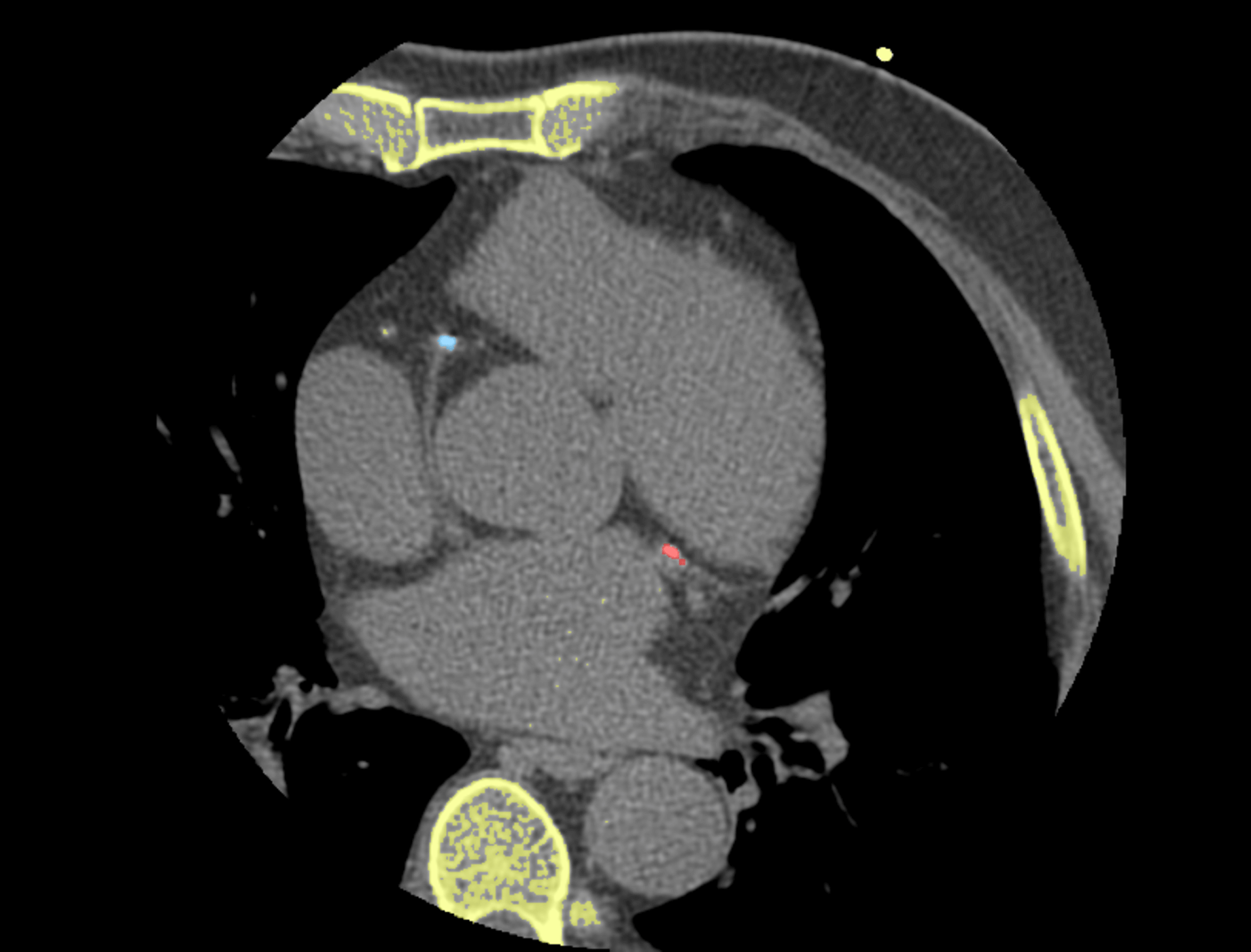 United Neuro (uWS, uReal, uSmart) | United-Imaging Korea Healthcare