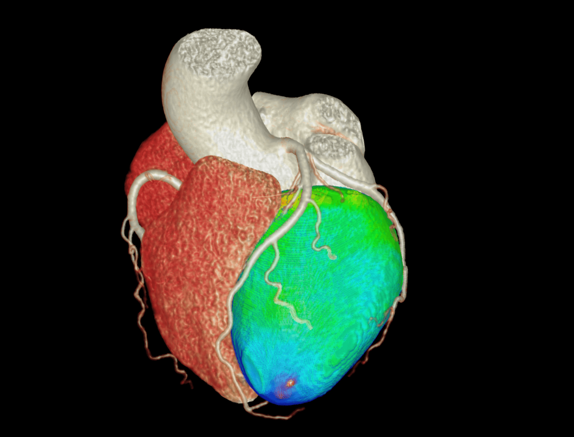 United Neuro (uWS, uReal, uSmart) | United-Imaging Korea Healthcare