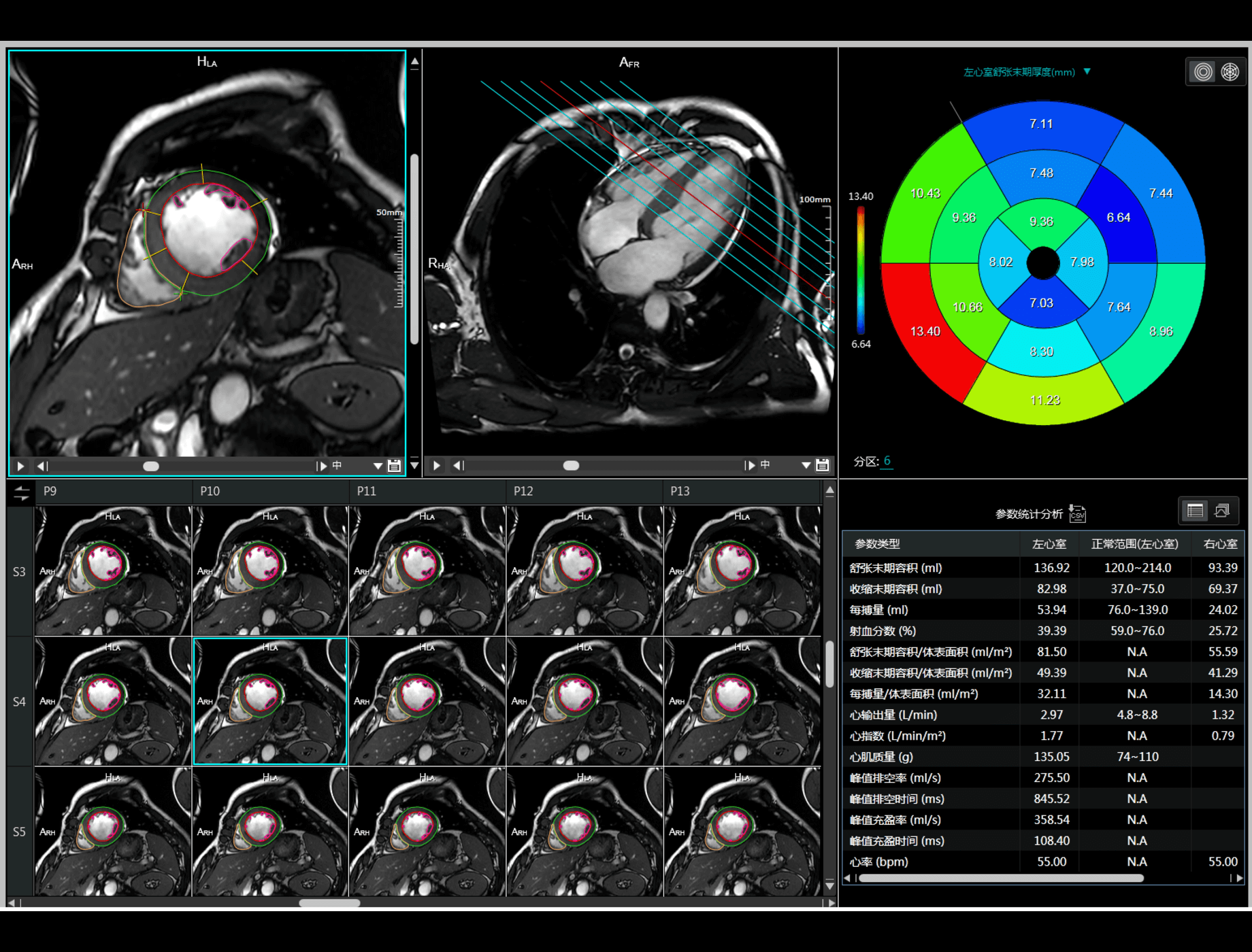 United Neuro (uWS, uReal, uSmart) | United-Imaging Korea Healthcare