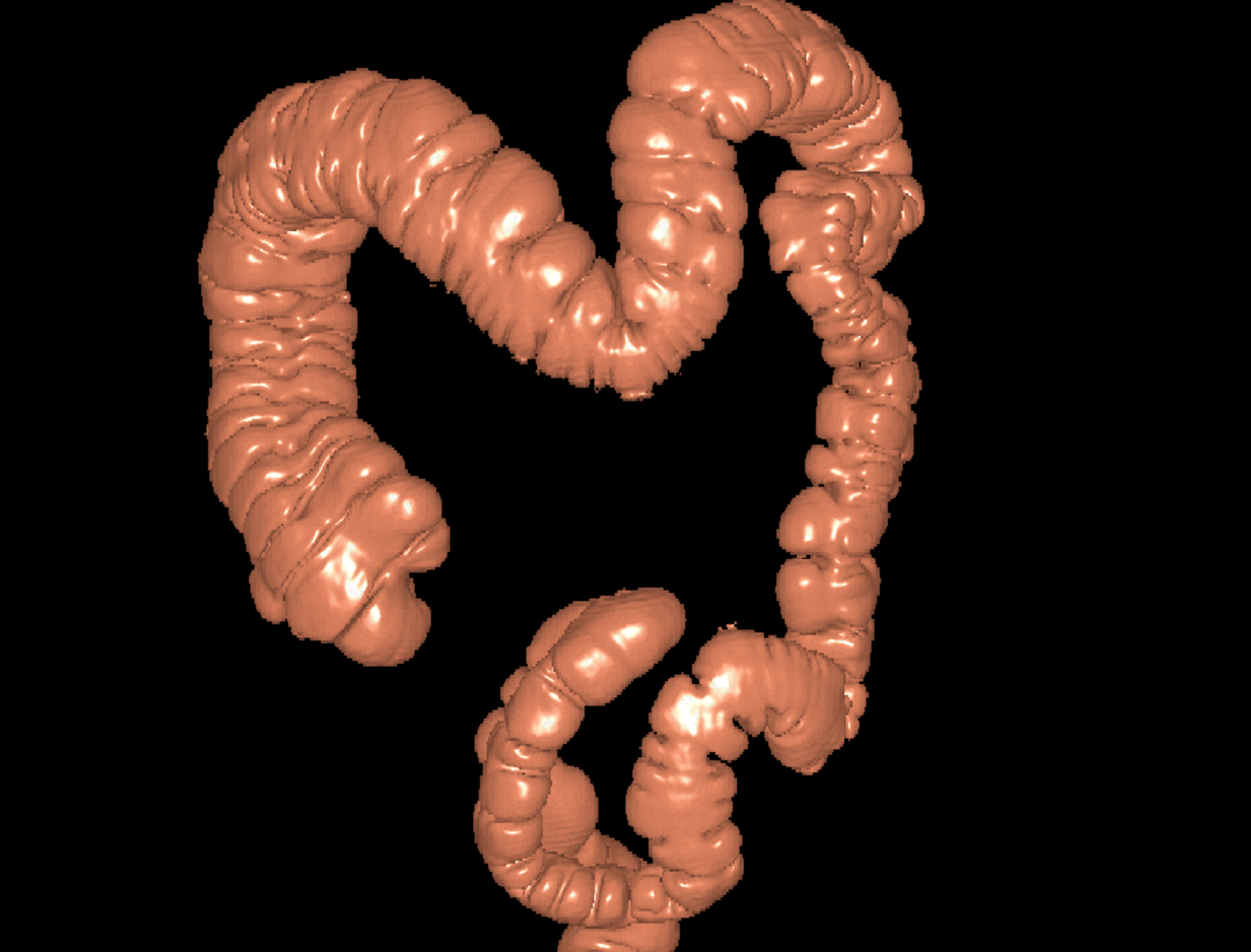 United Neuro (uWS, uReal, uSmart) | United-Imaging Korea Healthcare