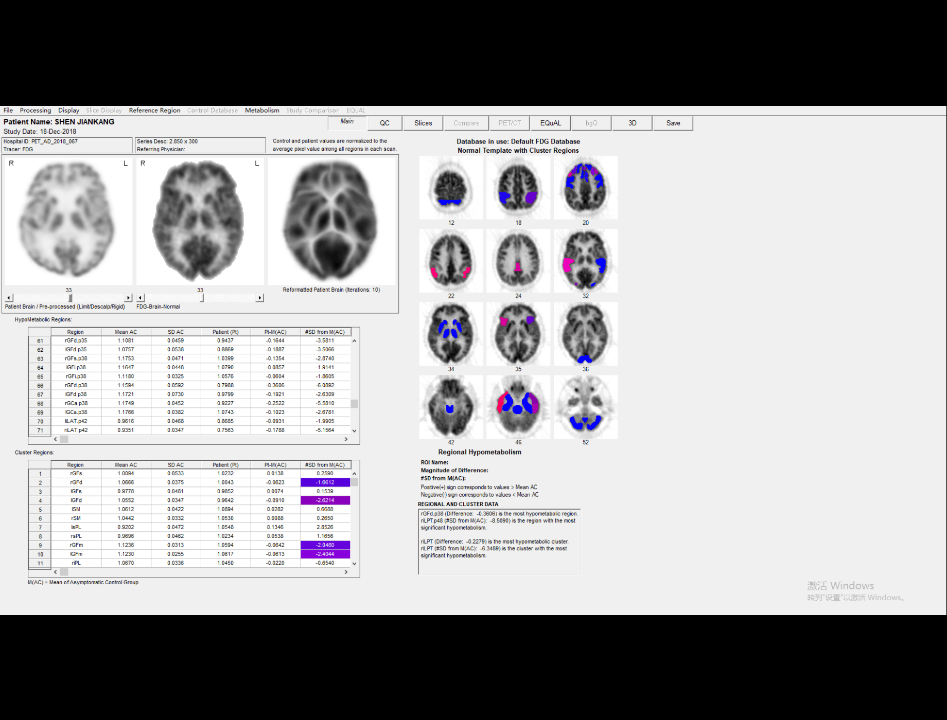 United Neuro (uWS, uReal, uSmart) | United-Imaging Korea Healthcare