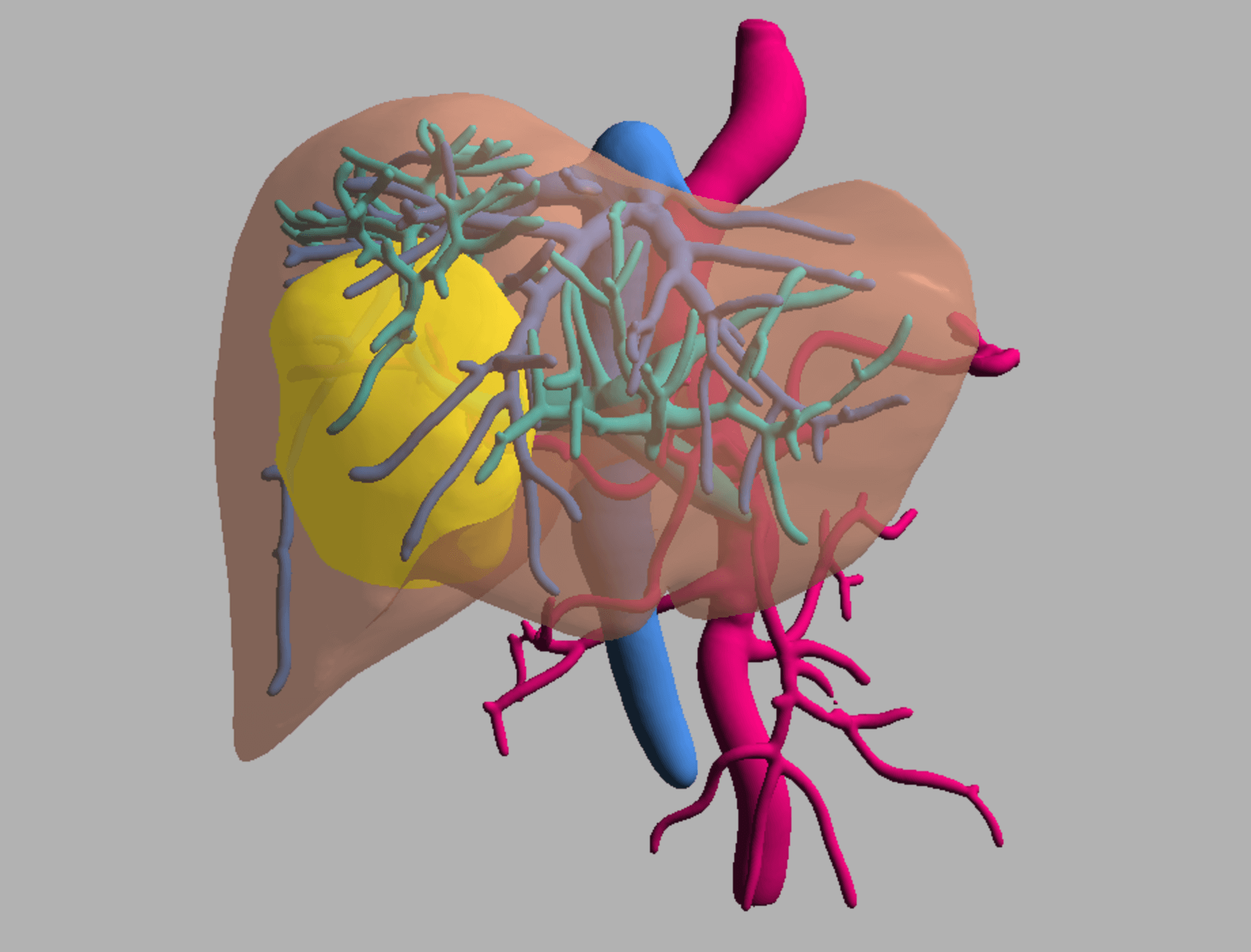 United Neuro (uWS, uReal, uSmart) | United-Imaging Korea Healthcare