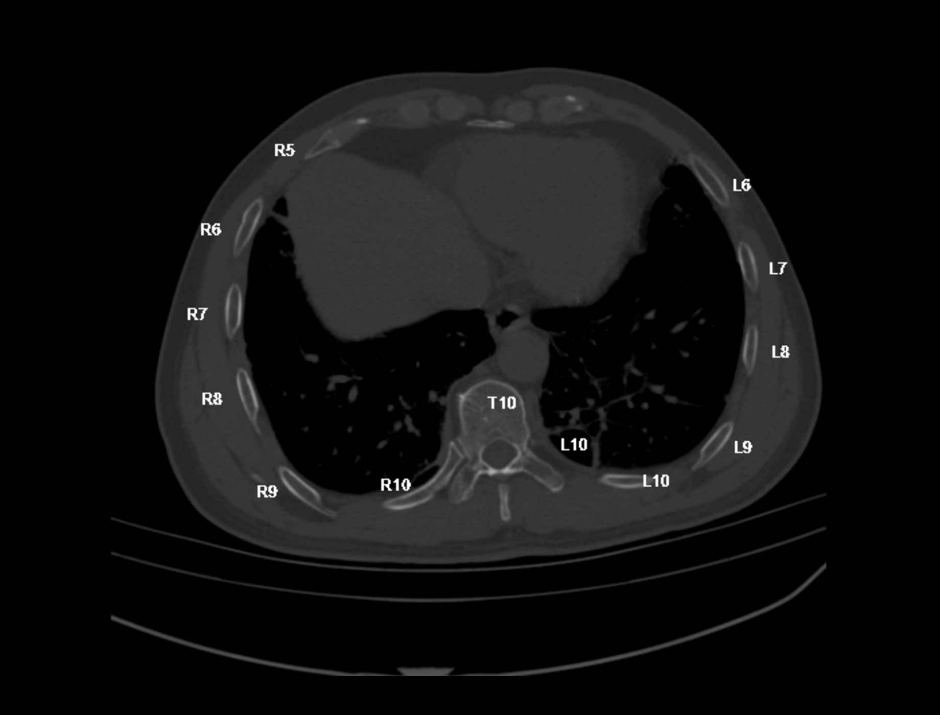 United Neuro (uWS, uReal, uSmart) | United-Imaging Korea Healthcare