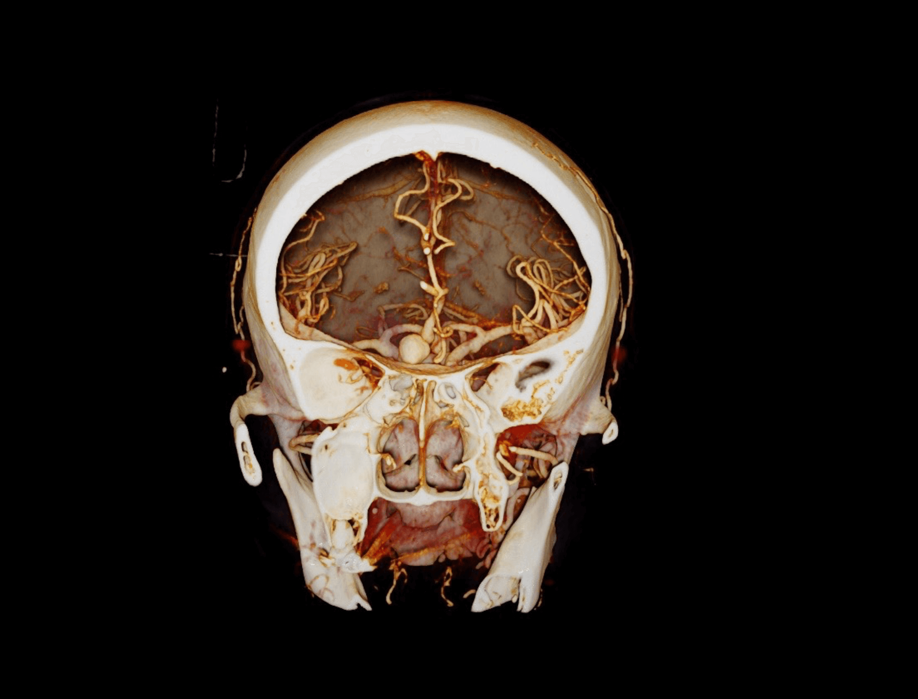 United Neuro (uWS, uReal, uSmart) | United-Imaging Korea Healthcare