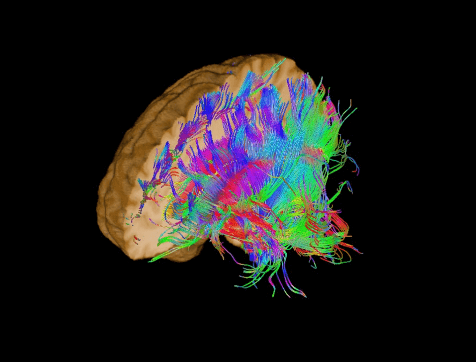 United Neuro (uWS, uReal, uSmart) | United-Imaging Korea Healthcare