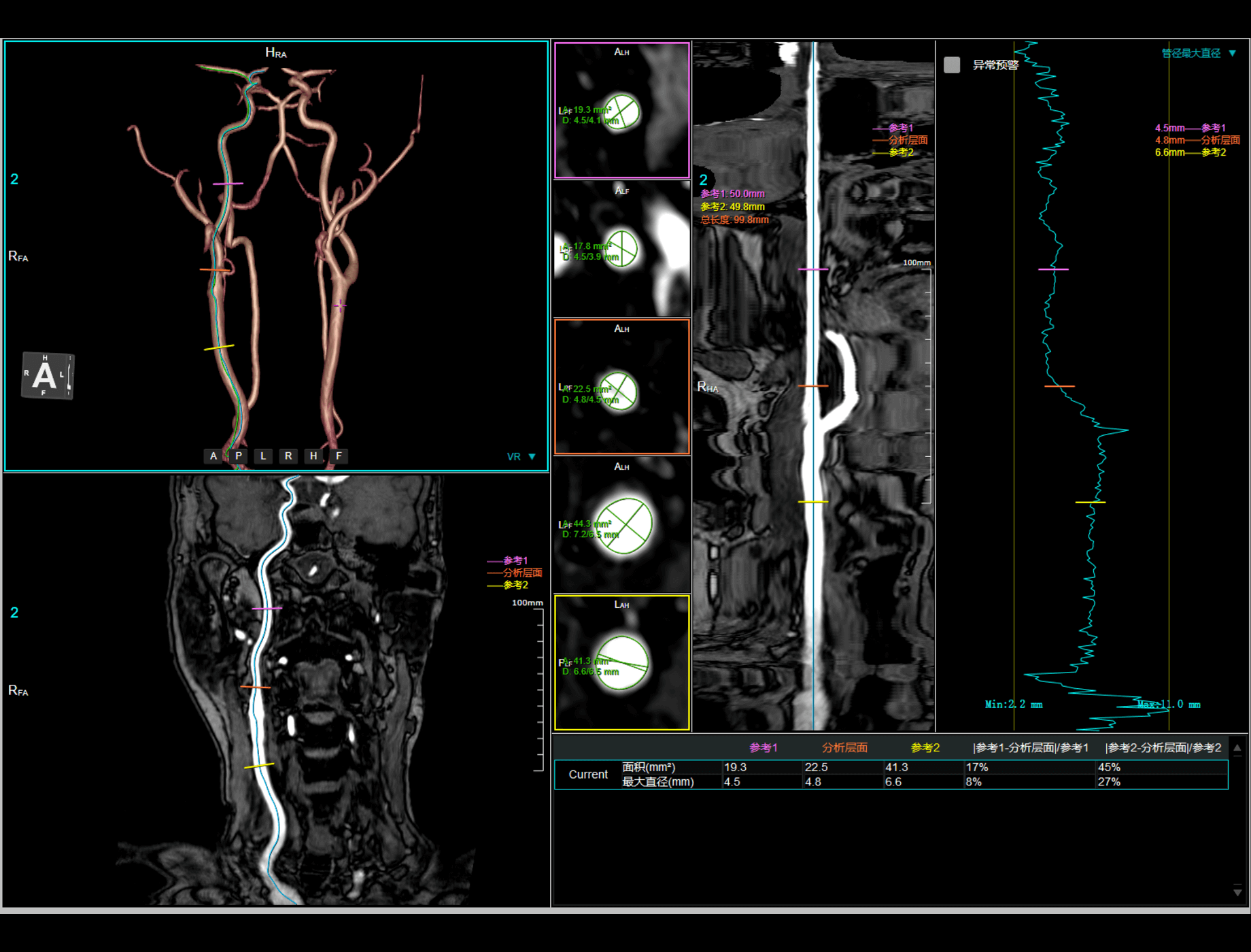 United Neuro (uWS, uReal, uSmart) | United-Imaging Korea Healthcare