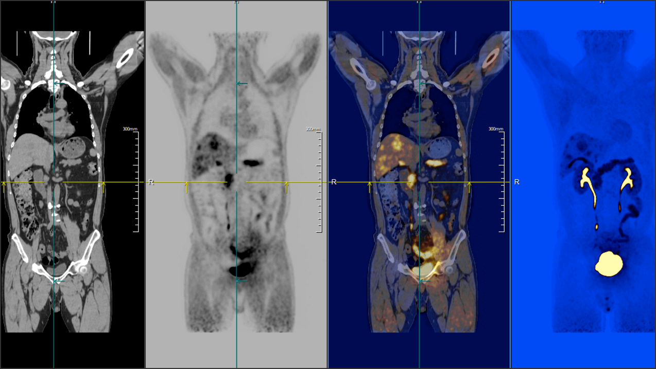 United Neuro (uWS, uReal, uSmart) | United-Imaging Korea Healthcare