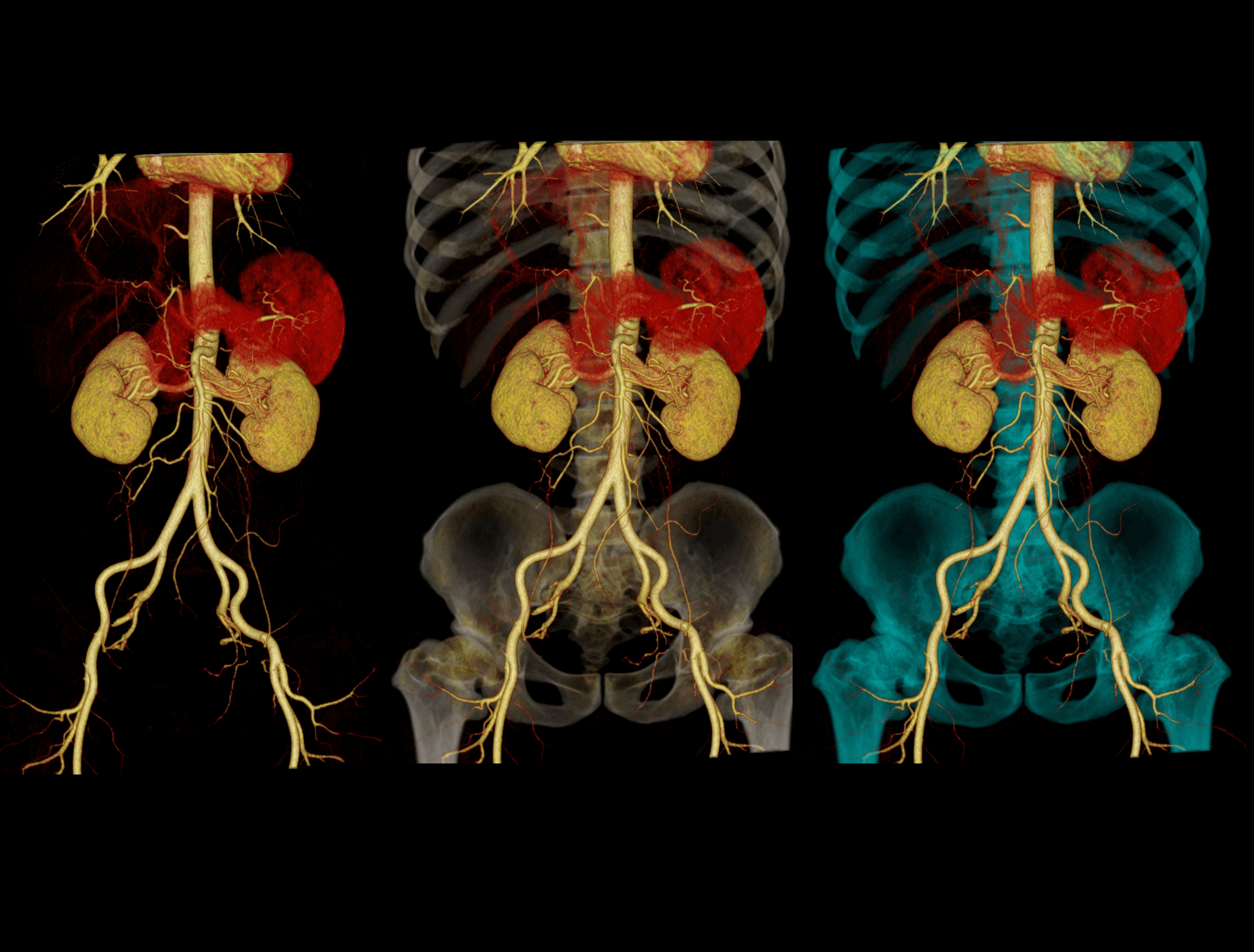 uCT 528: 40/80-slice CT with low radiation dose and Z-Detector